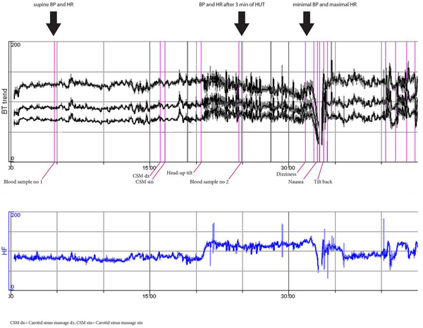 Portal:Cardiovascular system/Selected picture - MEpedia